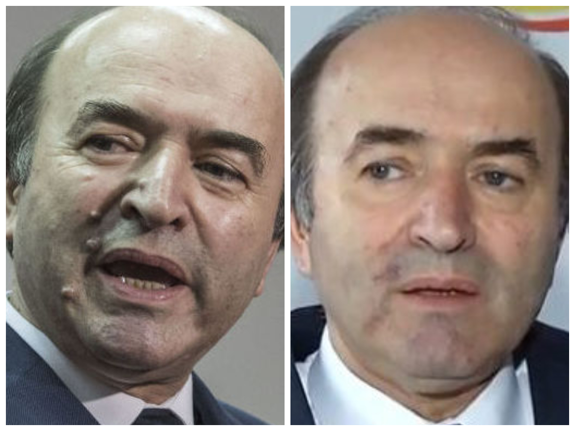 Tudorel Toader și-a scos negii de pe față, dar a rămas cu cei de pe ...
